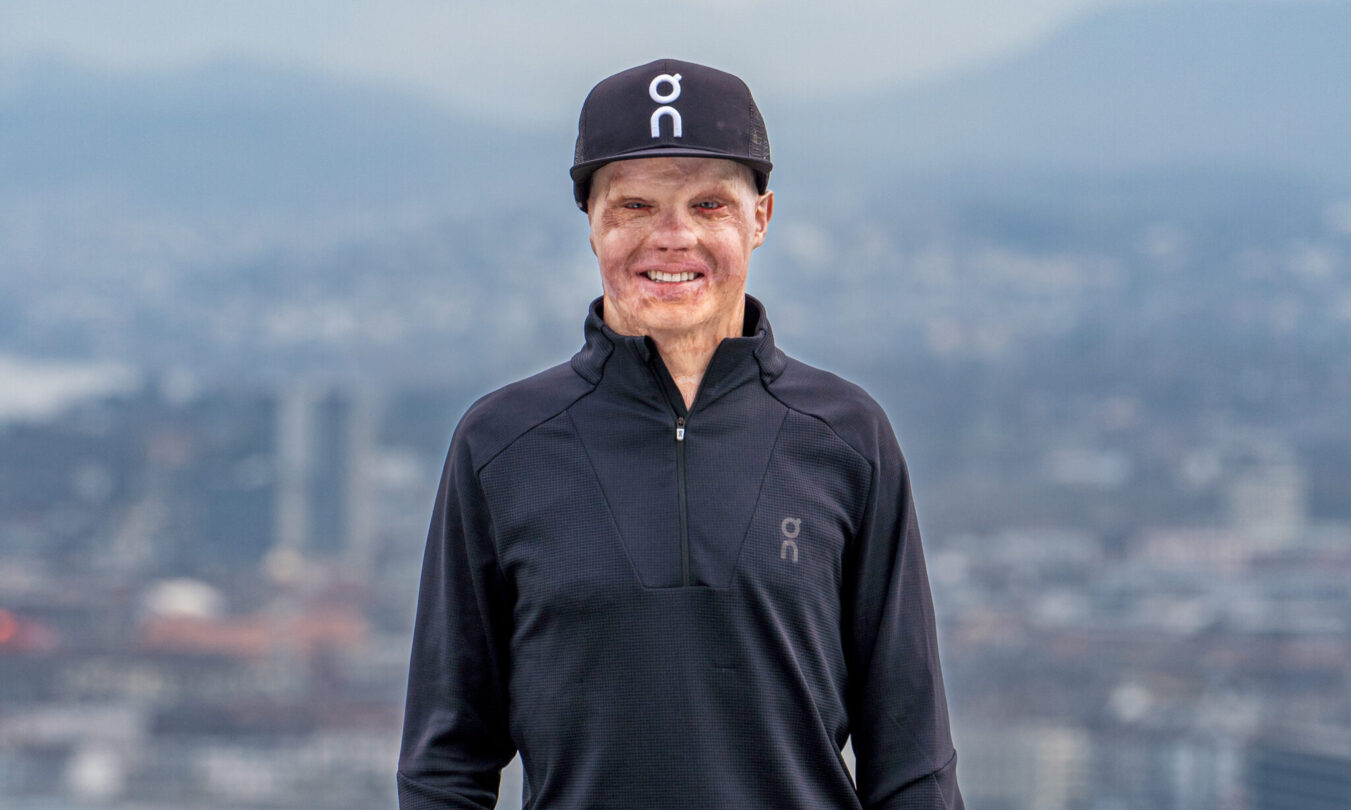 Podcast mit Philipp Bosshard: Triathlet nach Brandunfall – Pushing Limits